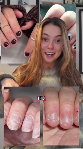 Easy Gel Nail Hacks for Perfect At-Home Nails