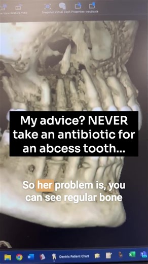 283K views · 523 reactions | Antibiotics aren’t a cure for abscessed...