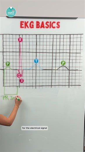 EKG Basics: Part 2 🫀⚡ →PR interval: Start of atrial depolarization ➡️start of ventricular depolarization →ST segment: Ventricular depolarization ➡️repolarization →QT interval: Total time for ventricular depolarization & repolarization Anatomy & Physiology Navigator: https://nurseinthemaking.co/ap-navigator #NursingSchool #NursingStudent #FutureNurse #StudentNurse #NurseInTheMaking #NCLEXPrep #EKG #ECG #CardiacBasics #HeartRhythms #CardiacNursing #EKGStrips | Nurse In The Making