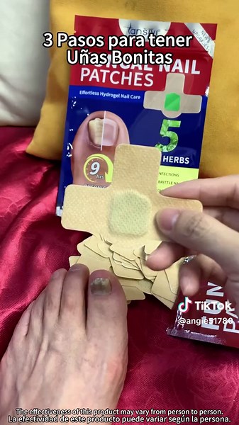 Try it now🌟💅#nail #fyp #yellownails #nailcare #nailfungus