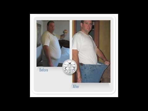 100 Gastric Sleeve Before and After pics | Weight Loss Surgery | VSG Results