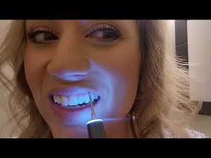 does home ultrasonic scaler work for teeth cleaning?