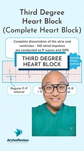 37K views · 352 reactions | Time for our most serious heart...