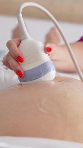 Ultrasound scan to a pregnant woman in hospital. Gynecologist using transducer on female's belly during sonography procedure. Vertical