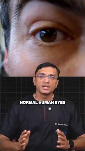 caloric reflex test #viral #trending #youtubeshorts #youtube #reels #instagram #education