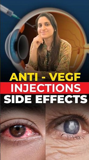 Anti - VEGF Injections Side Effects And Complications