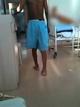 Bilateral Foot Drop in Polyarteritis Nodosa