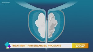 The most common problem for men over 50