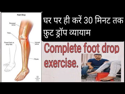 "Complete Exercise for Foot Drop Recovery" .Do foot drop 30 minute exercise at home.