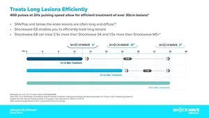 Shockwave E8 Product Overview and Physician Experience