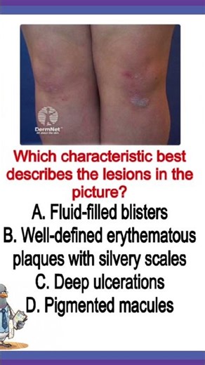 USMLE Step 1 MCQ | Dermatology Question | Medical Quiz