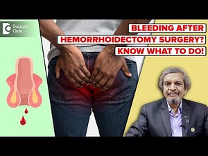 BLEEDING after PILES/HEMORRHOID SURGERY| Hemorrhoidectomy Recovery-Dr.Rajasekhar MR| Doctors' Circle