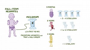 Video: Pediatric constipation: Clinical - Video Explanation! | Osmosis | Osmosis