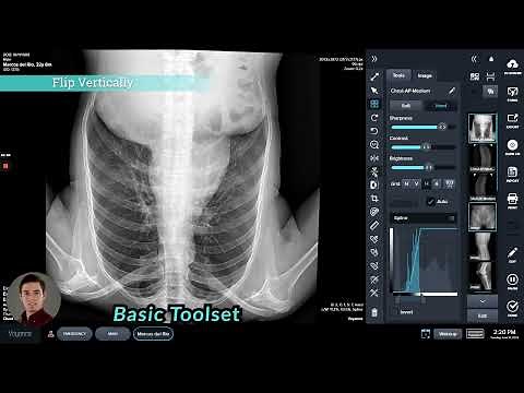 Voyance Digital X-ray Software - Tools Overview