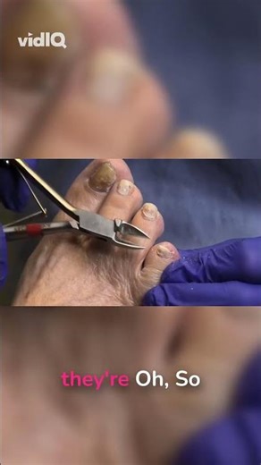 How Often Should You See a Podiatrist (Insurance Tips!)