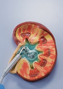 Medical Basics: Common Procedures You Should Know | Green Bean