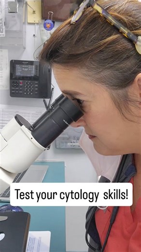 MORE here ⬇️ These are acantholytic keratinocytes ( image from awanui veterinary) A helpful feature of PF ( Pemphigus Foliaceus) is that acantholytic cells are easy to identify on cytology. (When desmosomes that weld keratinocytes together are disrupted, keratinocytes separate from one another, and appear as acantholytic cells on skin cytology) However, acantholysis is not specific to PF! Other diseases—most notably superficial pyoderma (SP) like impetigo—can also produce acantholytic cells and 