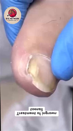 Nail & Home Safety: Best Flu Prevention Kits for Office or Family Use #fluprevention #healthtips #wellness | Bye