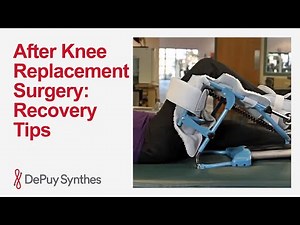 Knee Replacement Surgery: Recovery Timeline, Exercises and Post-op Care | DePuy Synthes