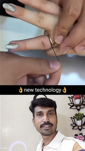 how to remove a ring from swollen finger with string #shorts