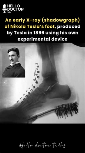 An early X-ray (shadowgraph) of Nikola Tesla’s foot, produced by Tesla in 1896 using his own experimental device. #xray #scary #documentary #history #health #experiment | hellodoctortalks