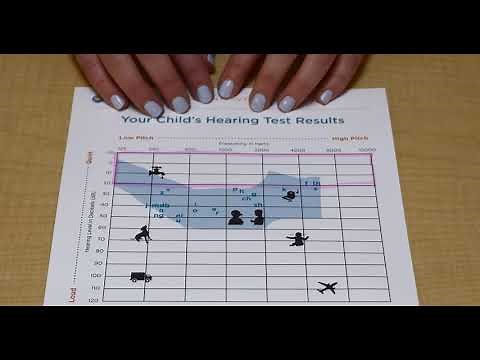 How to read an audiogram