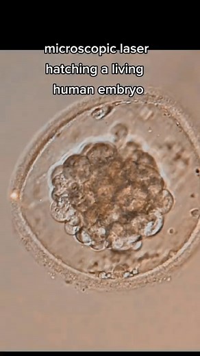 laser hatching a human embryo #embryo #laser #infertility #IVF #ttc #infertilitywarrior #ivfwarrior #infertilityjourney #Reels #reelsvideo #reelsviral #reelinstagram | Steven Palter