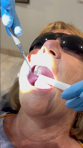 Clinical Crown Removal in Action | Case # 2