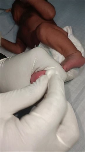 Shakeel1912 on Instagram: "NICU baby RBS check ✔️ by kit #motivation #video #virals #nursing work #gnm"