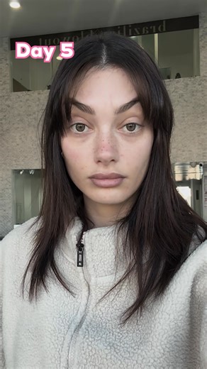 It can take 7-10 days for Botox to fully work its magic, but once it does... 🤌 . . . #Botox #skincare #aestheticdermatology #laseraway | LaserAway