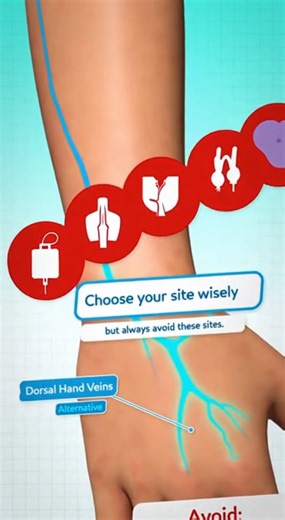 🩸💉 Mastering Venipuncture Starts with Choosing the Right Vein The median cubital vein is your first choice — large, stable, and typically the least painful. If needed, the cephalic vein is a solid second option, though it may roll more. Use the basilic vein with caution due to its proximity to arteries and nerves. Hand veins are an alternative, but often more sensitive. 🚫 Always avoid: IV arms, fistulas or grafts, mastectomy sides, and areas with hematoma. Save this for clinicals and your nex