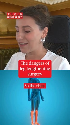 The rising popularity of leg lengthening surgery: how safe is it? Listen to the full story on The Week Unwrapped at the link in the comments 🔗 #height #surgery #cosmeticsurgery #healthrisks | The Week UK