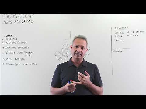 Causes of Lung Abscesses