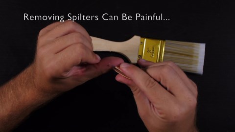 How to painlessly remove splinters from your skin