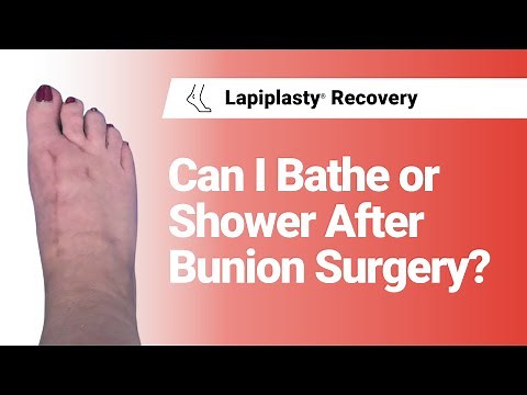Can I Bathe Or Shower After Bunion Surgery? | Lapiplasty® Recovery