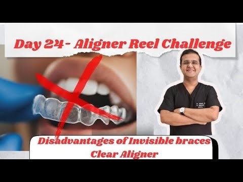 Invisalign and Clear Aligners Problems | Honest dentist opinion . # aligner #invisalign