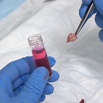 Isolation of Primary Microglia from Murine Br - JoVE Journal