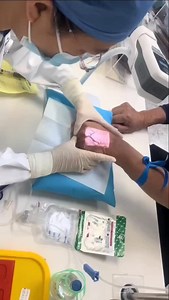 This hospital has developed advanced vein-finding machines that use infrared light to detect and project veins