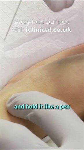 Taking a radial arterial blood gas sample #clinicalskills