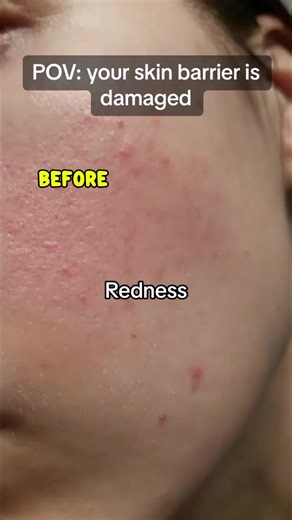 Enhance Your Look with Ordinary Glow Kit