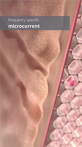 True Frequency Specific Microcurrent is a highly precise, low level application of specific energetic waveforms to stimulate the face. By promoting skin health on the energetic level, we’re helping to reduce the appearance of many of the signs of skin aging at their cause. | Bio-Therapeutic