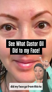 SEE WHAT ONE YEAR OF USING CASTOR OIL DID TO MY FACE! You can find my recommended oils by clicking on the taplink under my profile pic or by clicking on the link below: http://www.anorganicoasis.com/?ref=8decgh3c Morning: 1/2 tsp jojoba oil, 2-3 drops rosehip oil Evening: 1/2 tsp castor oil, 2-3 frankincence #menopause #menopauseeducator #castoroil #menopausesupport #antiaging #frankincense #over40skincare #castoroilbenefit #jojoba #rosehip #guasha #facefitness | Nicole Domuret