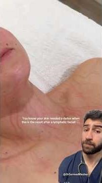 “Your Skin Needed a Detox” #wait