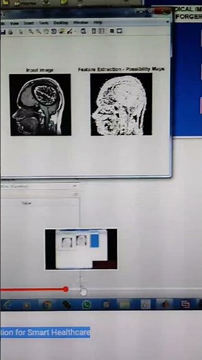 Medical Image Forgery Detection for Smart Healthcare | MATLAB PROJECT