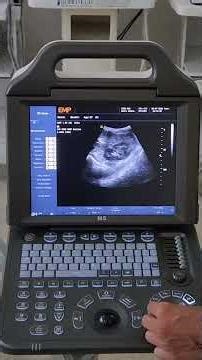 DEMO 2025 N5 C Best ever Power Doppler ultrasound machines Best price Sonotech