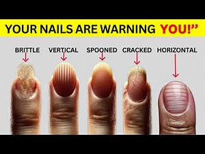 Nail Care Tips You NEED To Know