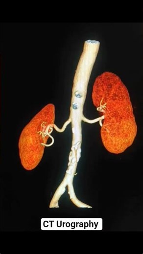 CT Urogram #radiology #medicalimaging #ctscan #cturogram #anatomy #ctimaging