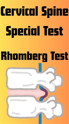 Romberg Test Explained | Positive Sign, Sensory Ataxia & Clinical Significance #shorts