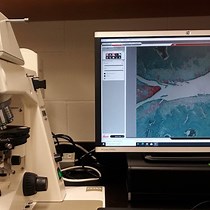 Video: Software-Assisted Quantitative Measurement of Osteoarthritic Subchondral Bone Thickness