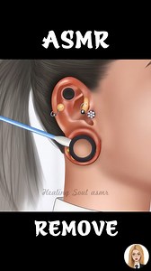 Pimple popping pustules #transformation #asmr #asmrsounds #skincare #skincareroutine #beauty #satisfying #acne #extrusion #lashes #deepcleaning | Nikolas Bushi